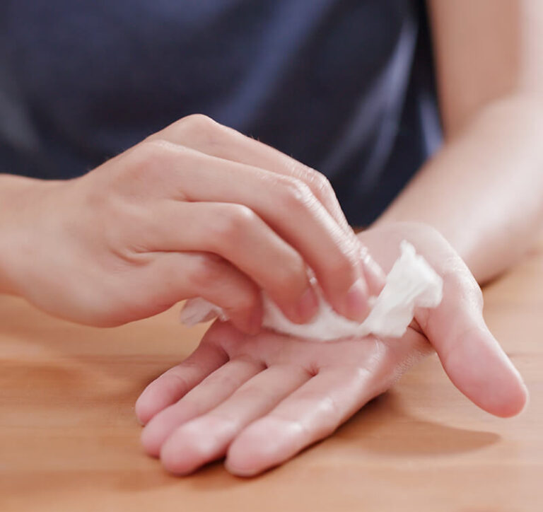 Botulinum toxin for excess sweating (hyperhidrosis)